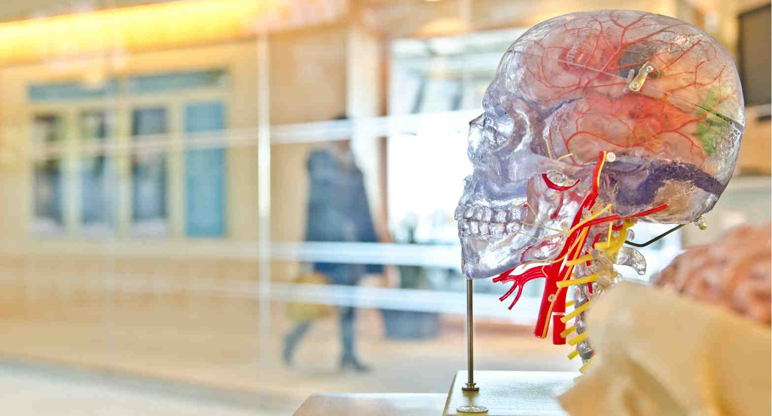 Smartengeld hersenschudding en hersenkneuzing - HIJINK